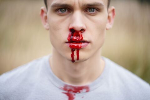 Saignement de nez : Causes et comment l’arrêter - cnerea.fr