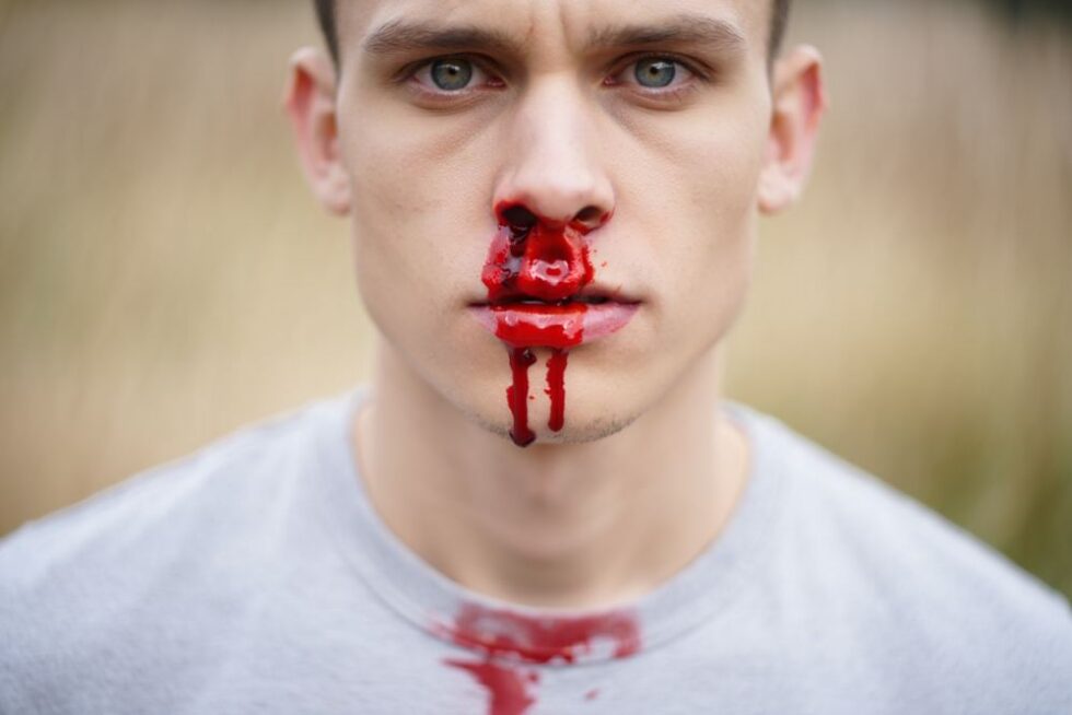 Saignement de nez : Causes et comment l’arrêter - cnerea.fr